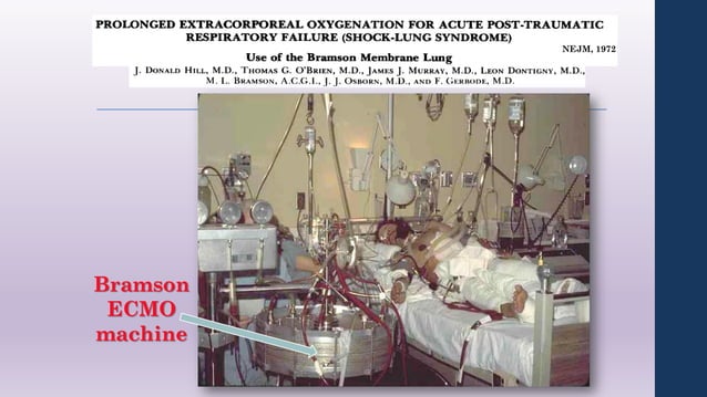 ECMO in Critical Care - Egyptian College of Critical Care Physicians
