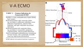 ECMO IN PREGNANCY critical care medicine.pptx