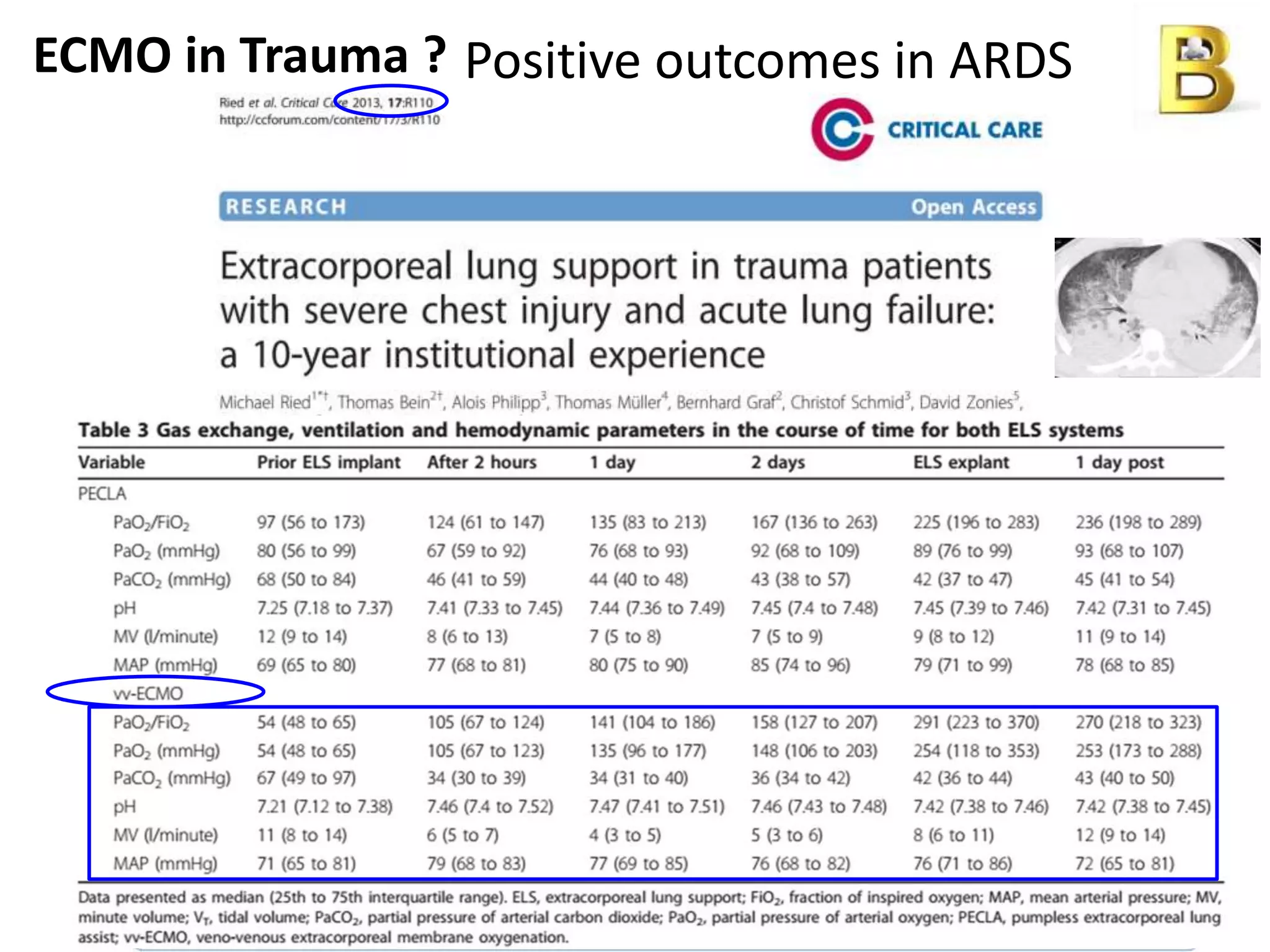 Role of extracorporeal life support in trauma patients | PPT