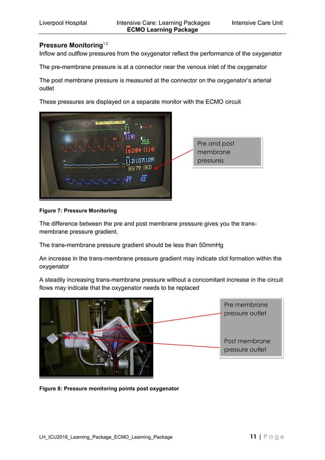 ECMO_Learning_package.pdf | Heart and Cardiovascular Diseases | Diseases and Conditions