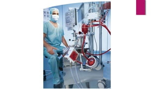 Ecmo - a basic overview. | PPT