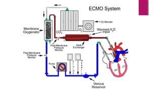 Ecmo - a basic overview. | PPT