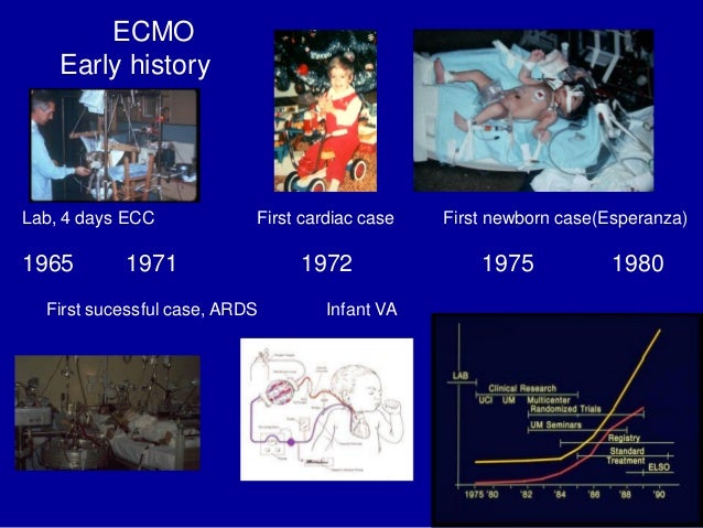 Ecmo : Past, Present & Future
