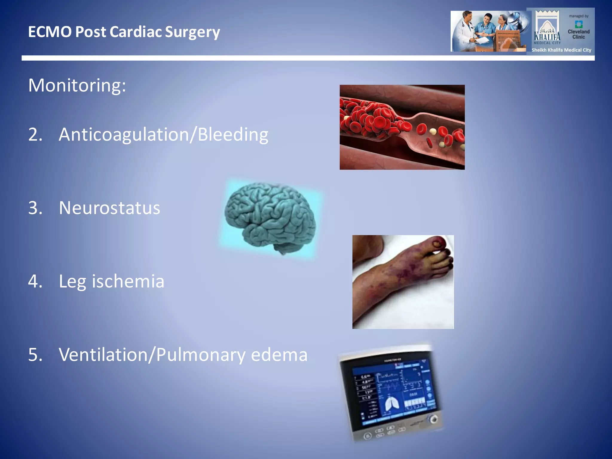 Ecmo Post Cardiac Surgery | PDF
