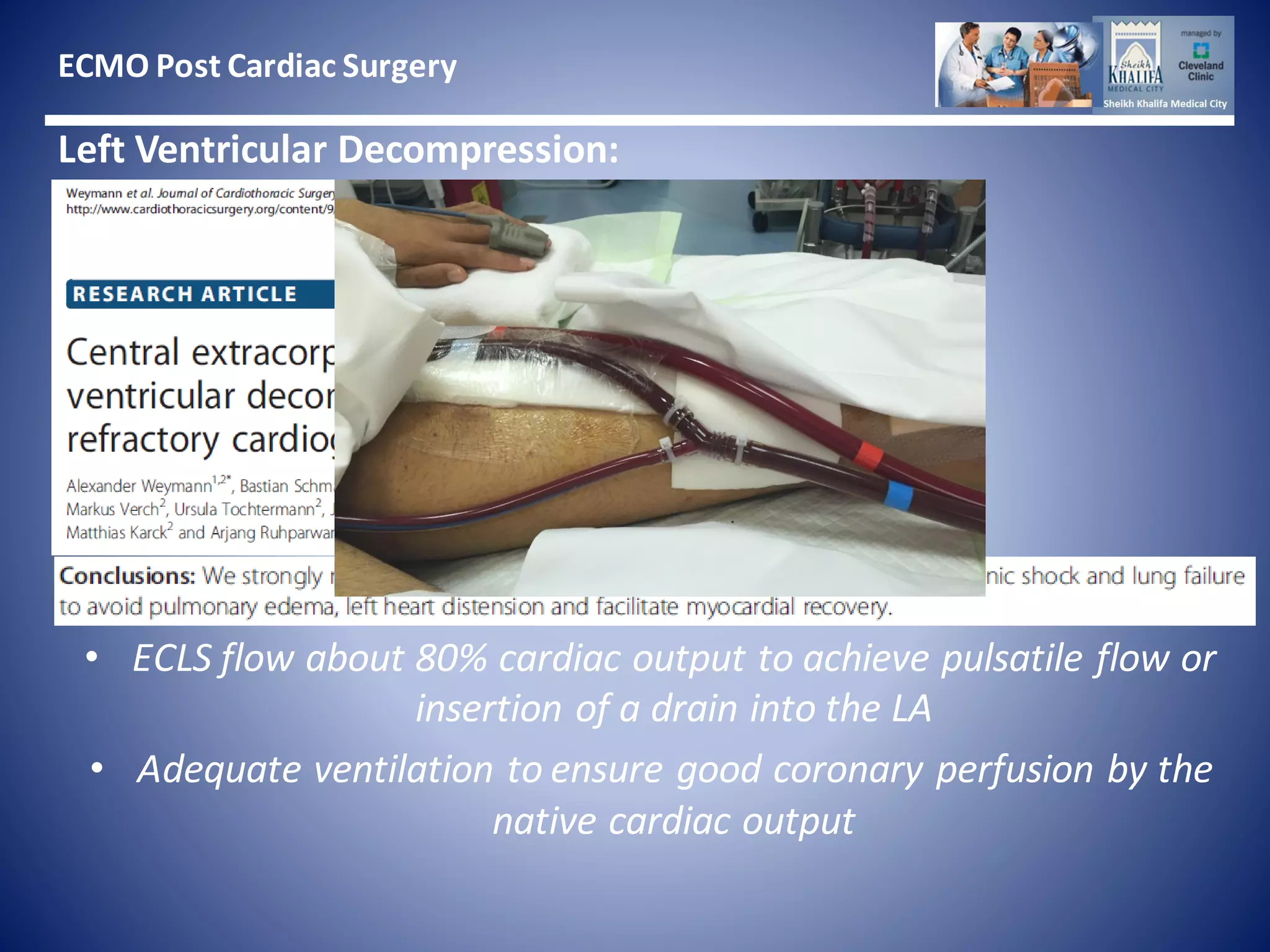 Ecmo Post Cardiac Surgery | PDF