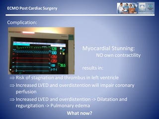 Ecmo Post Cardiac Surgery | PDF