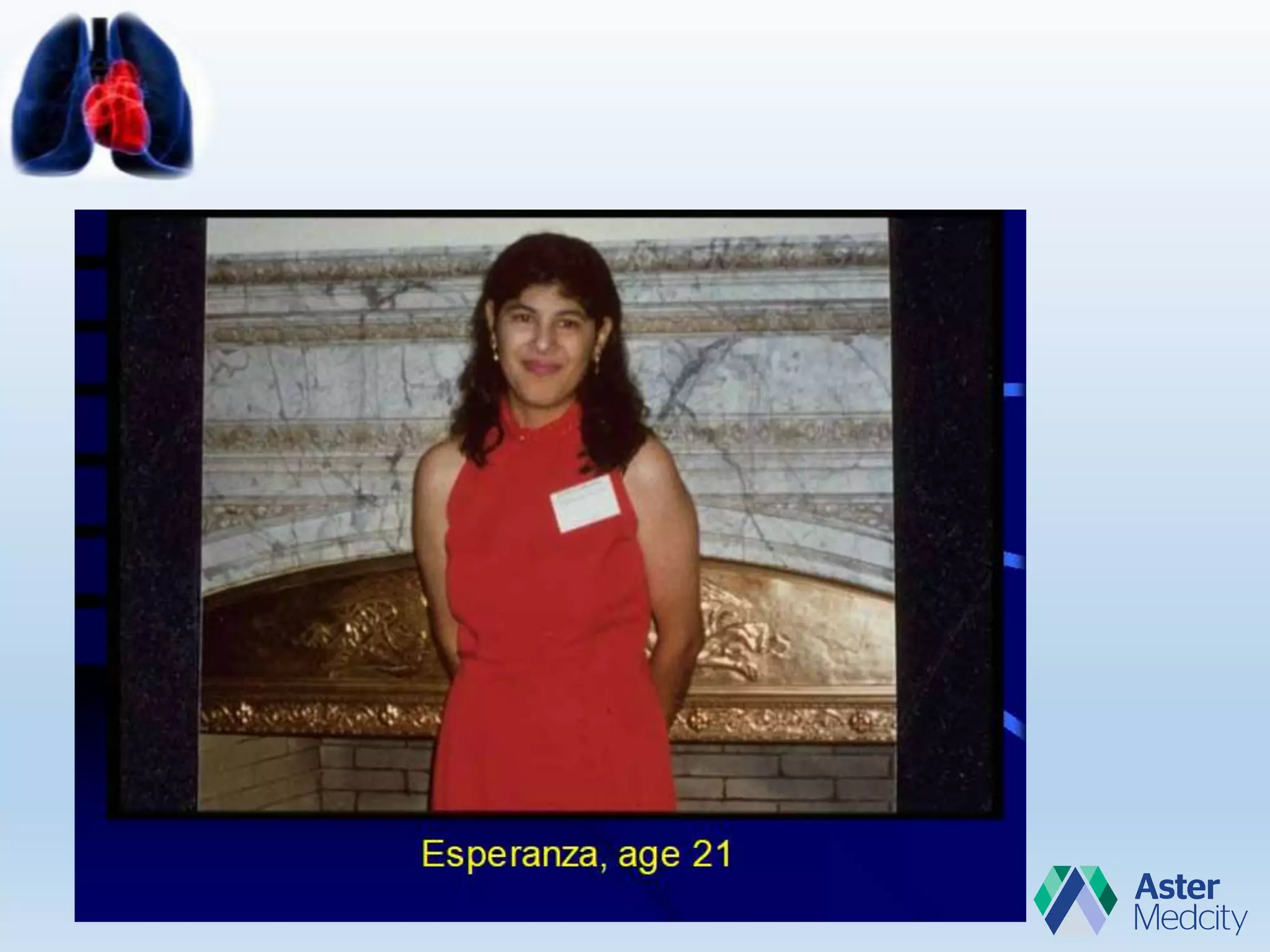 ecmopresentationfinal-140710054946-phpapp02.ppt