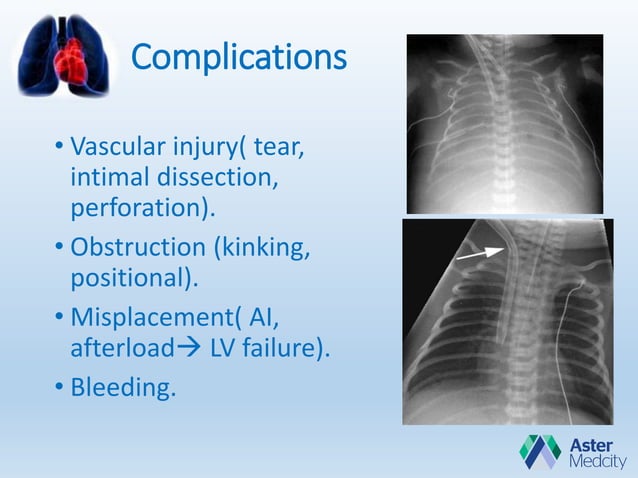 ecmopresentationfinal-140710054946-phpapp02.ppt