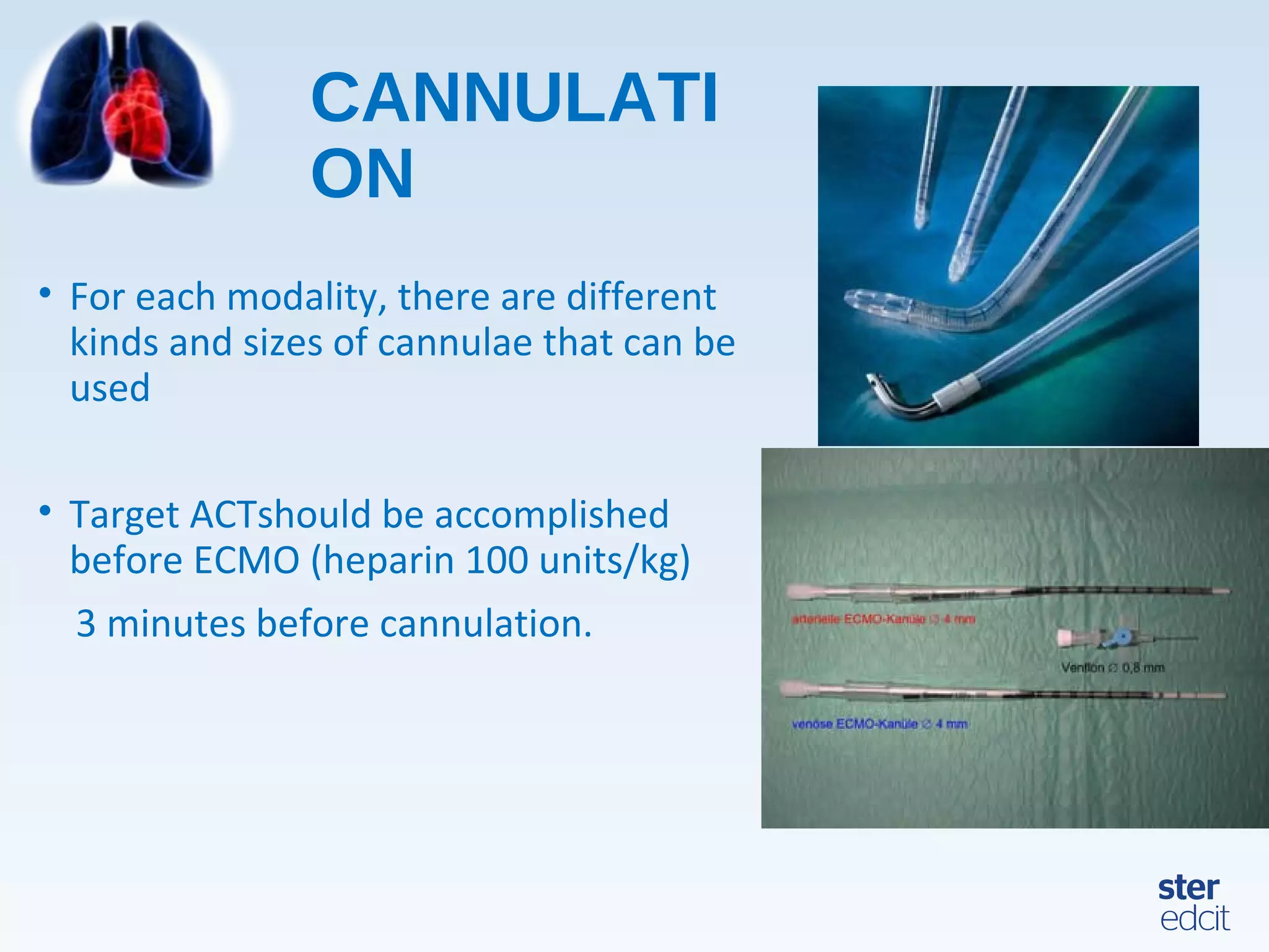 Ecmo presentation final | PPT