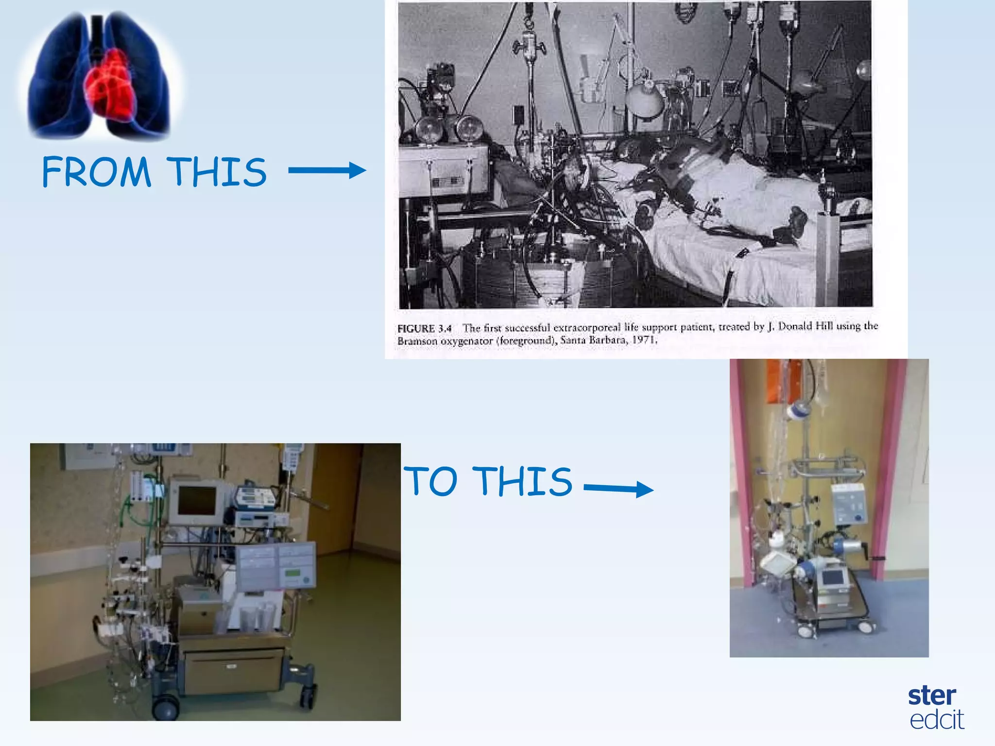Ecmo presentation final | PPT