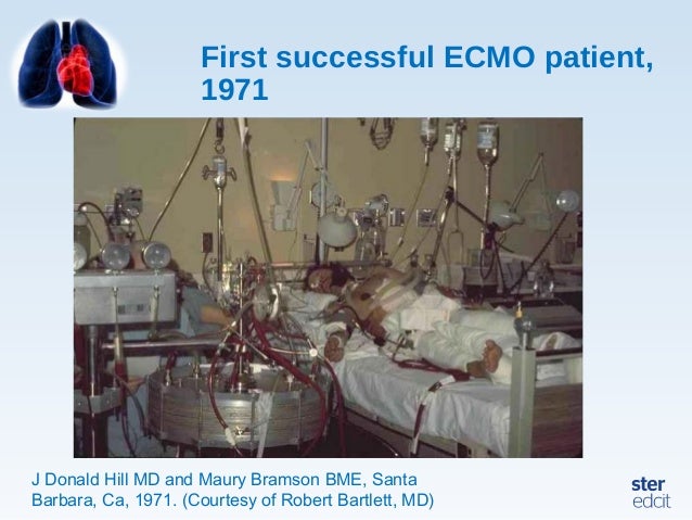 Ecmo presentation final