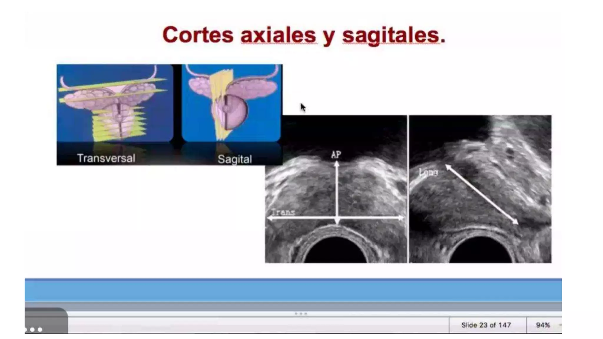 ECO-PROSTATA Y VEJIGA.pptx