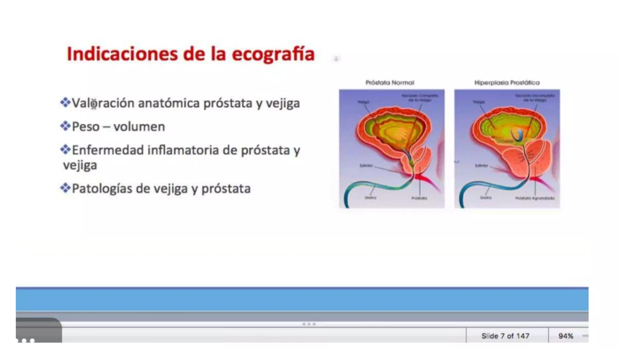 ECO-PROSTATA Y VEJIGA.pptx