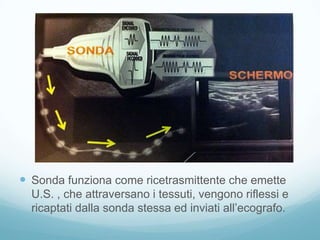 Ecoanatomia vasi periferici | PPTX