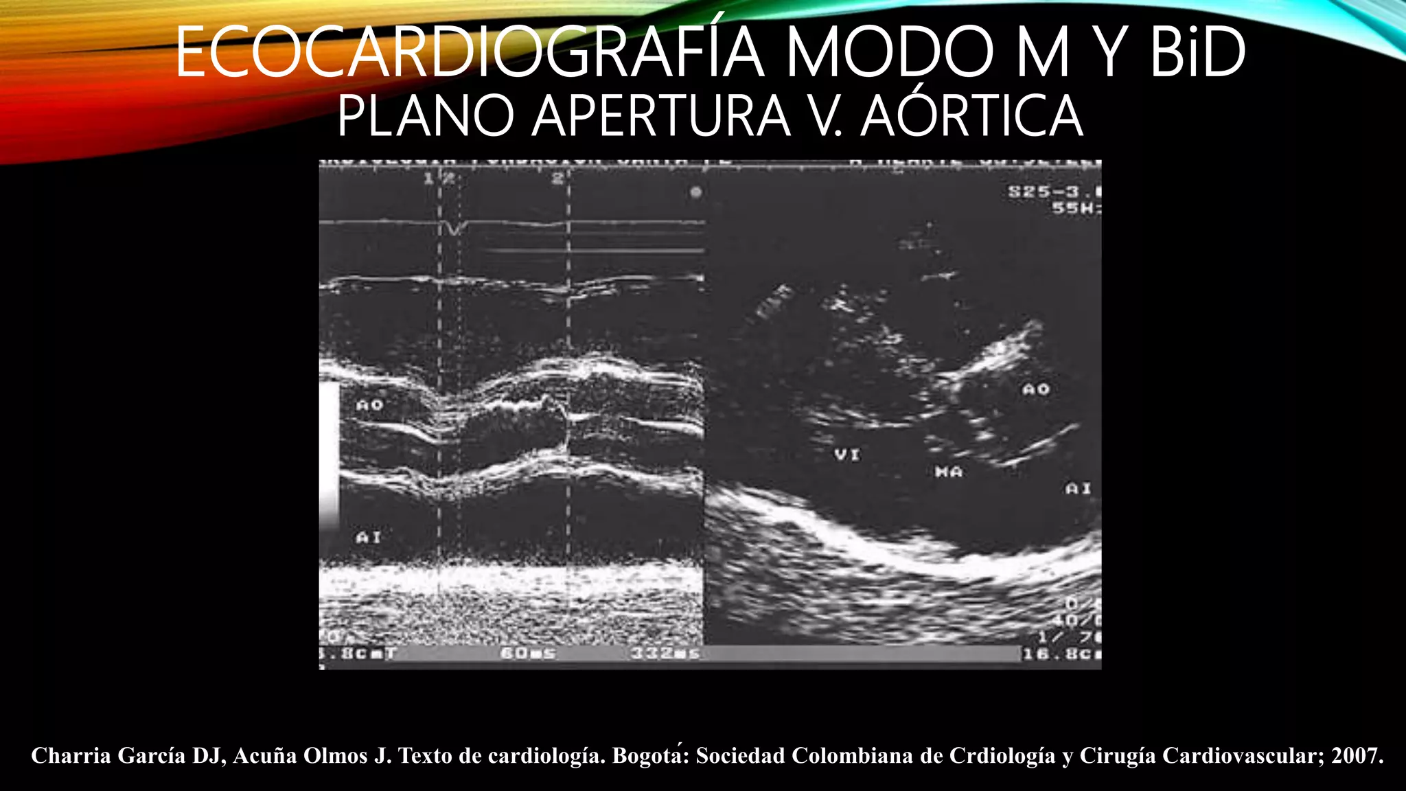 Ecocardiografia modo m, bidimensional y doppler color | PPTX