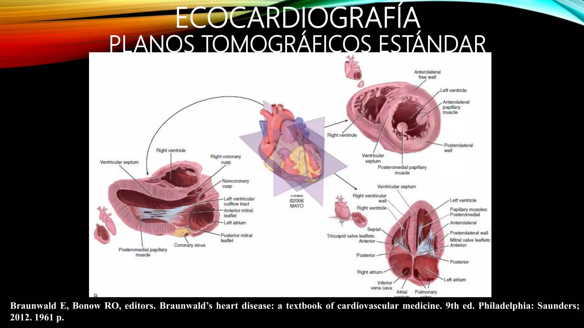 Ecocardiografia modo m, bidimensional y doppler color | PPTX