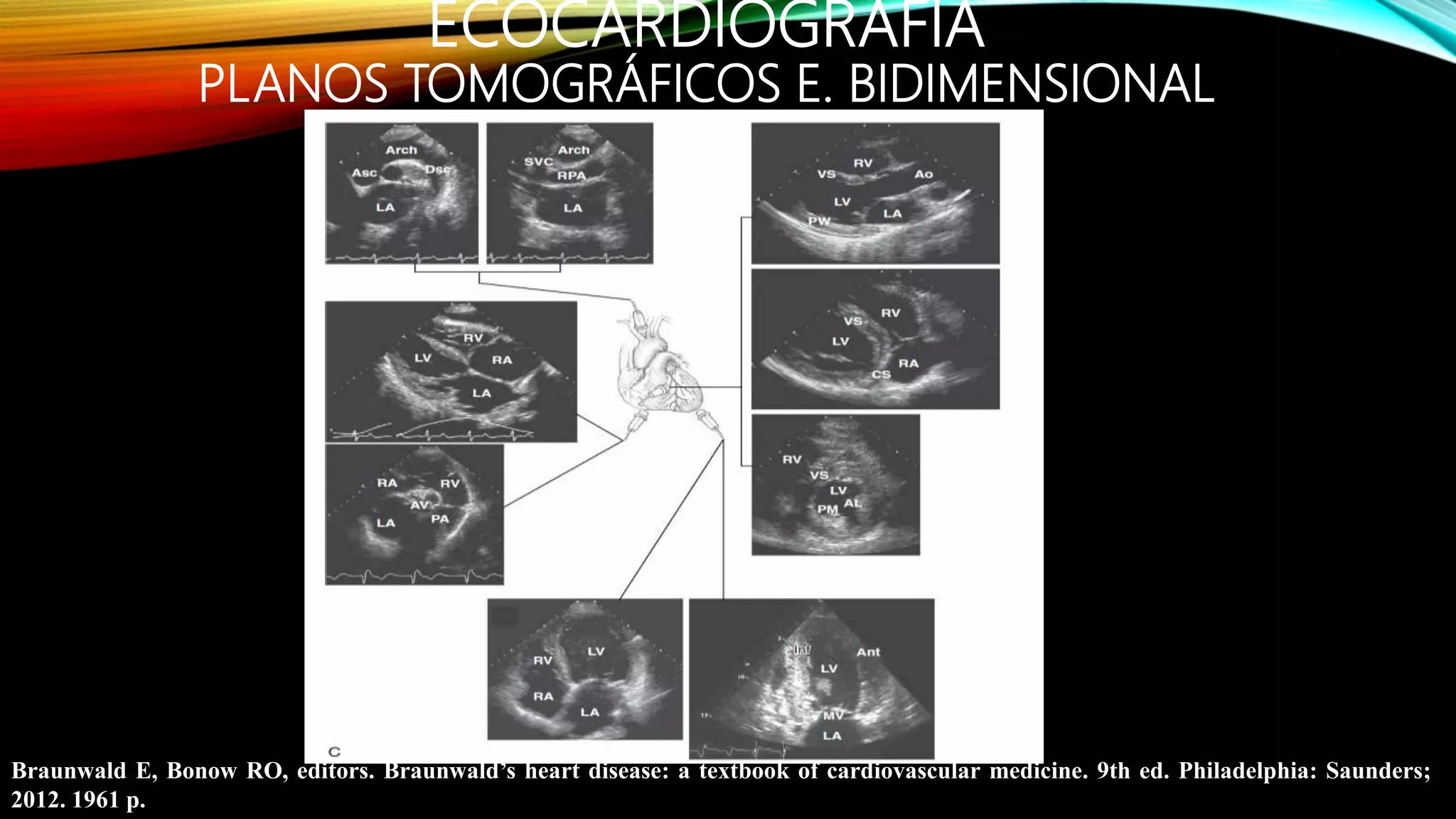 Ecocardiografia modo m, bidimensional y doppler color | PPTX
