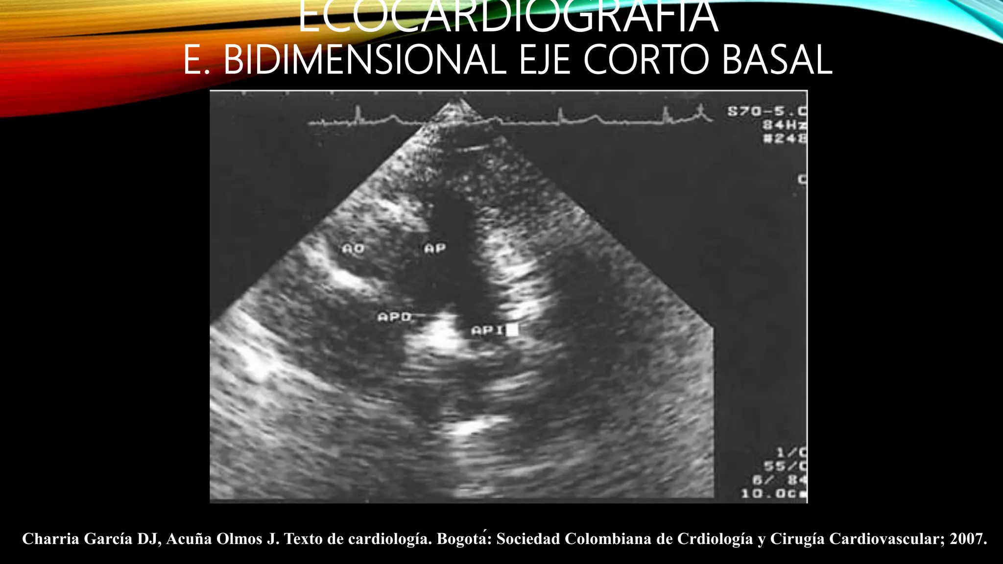 Ecocardiografia modo m, bidimensional y doppler color | PPTX