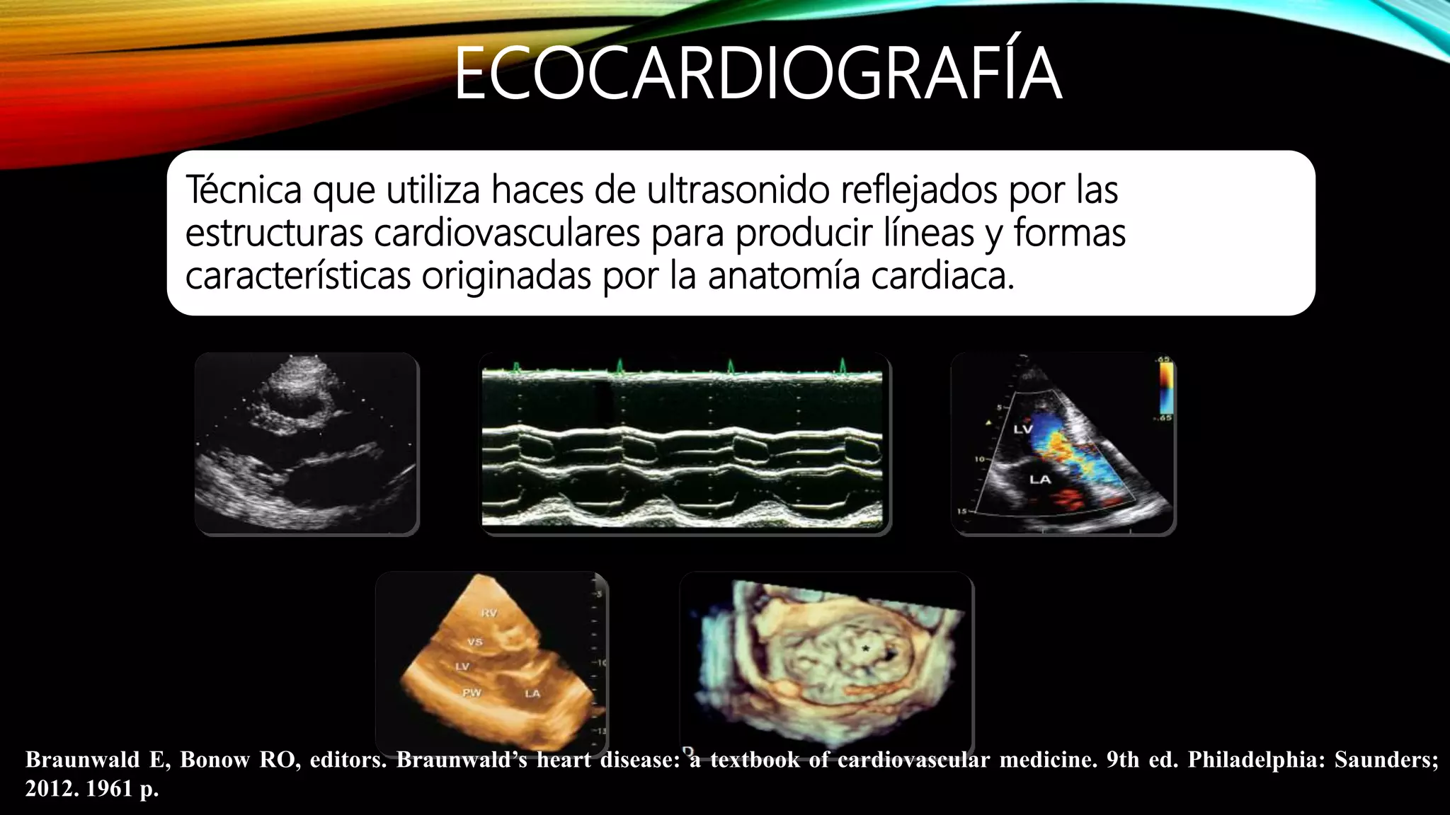 Ecocardiografia modo m, bidimensional y doppler color | PPTX