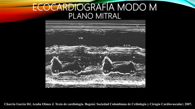 Ecocardiografia modo m, bidimensional y doppler color | PPTX