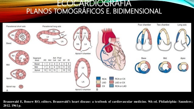 Ecocardiografia modo m, bidimensional y doppler color