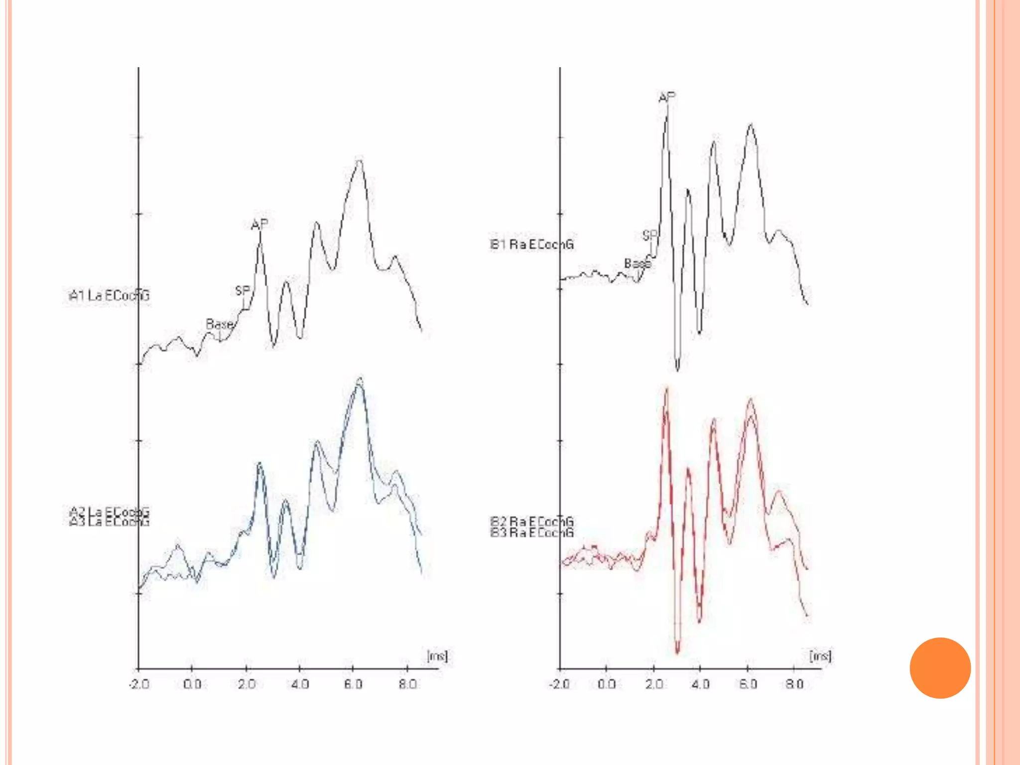 ecochG.pptx | Digital Audio | Computer Software and Applications