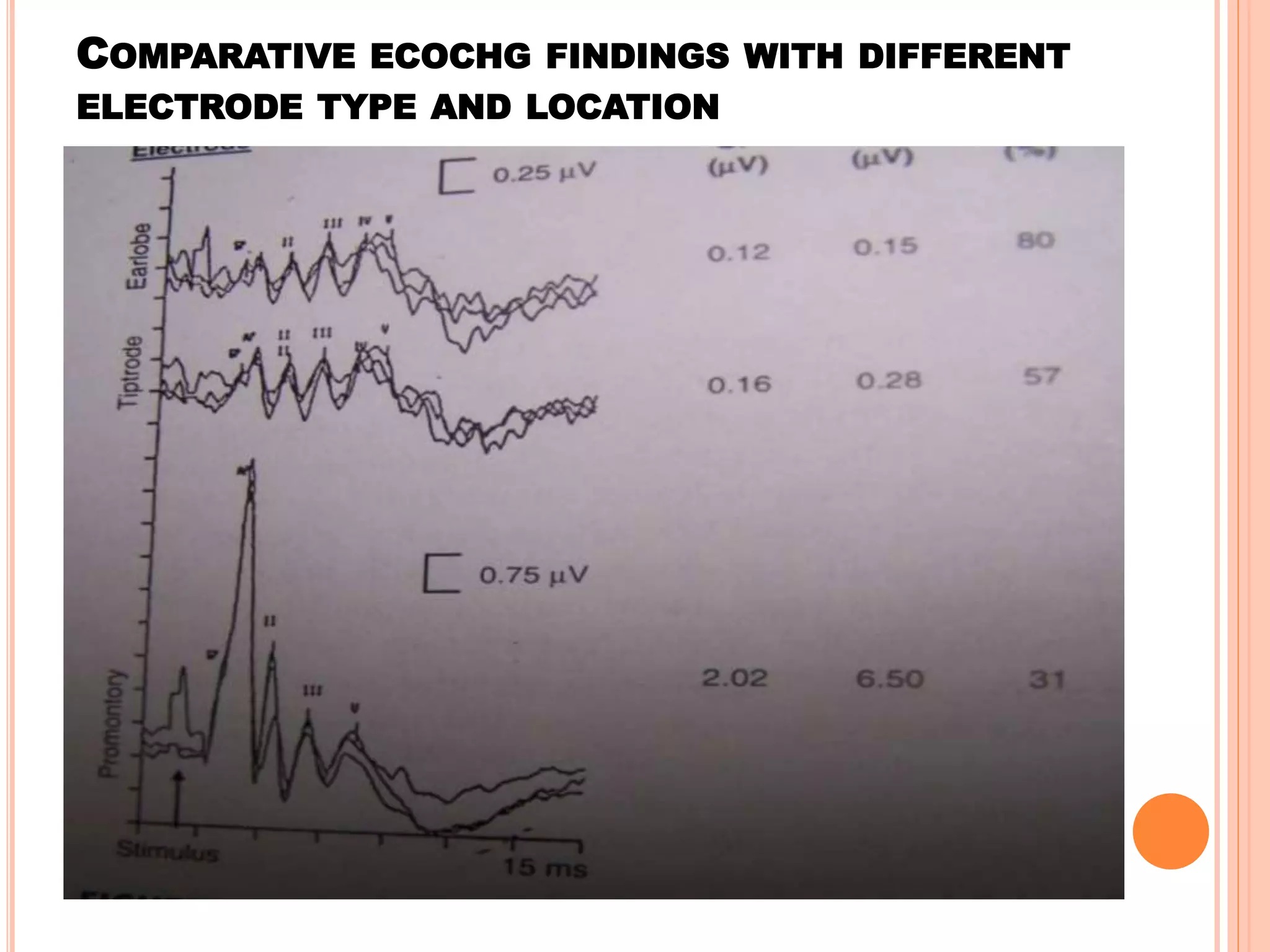 ecochG.pptx | Digital Audio | Computer Software and Applications