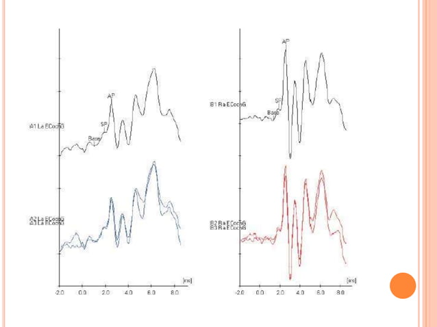 ecochG.pptx | Digital Audio | Computer Software and Applications