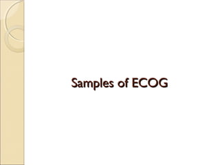 Electrocorticography | PPT