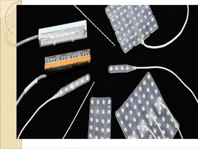 Electrocorticography