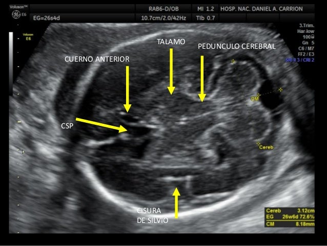 Ecografia de la Morfologia Fetal - Basico