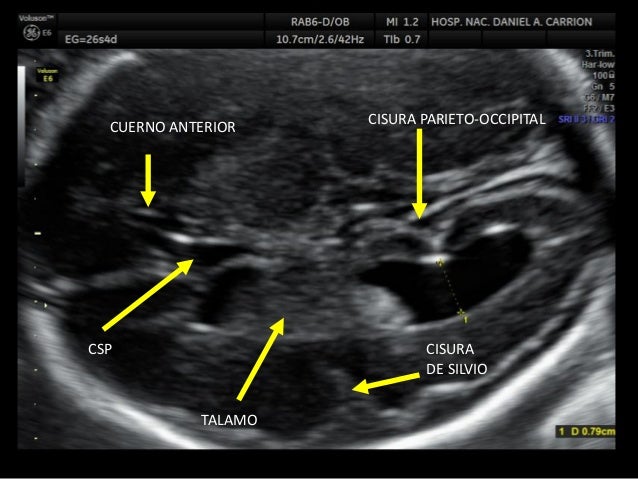 Ecografia de la Morfologia Fetal - Basico