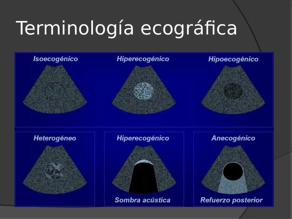 O Que é Hipoecóicas - RETOEDU