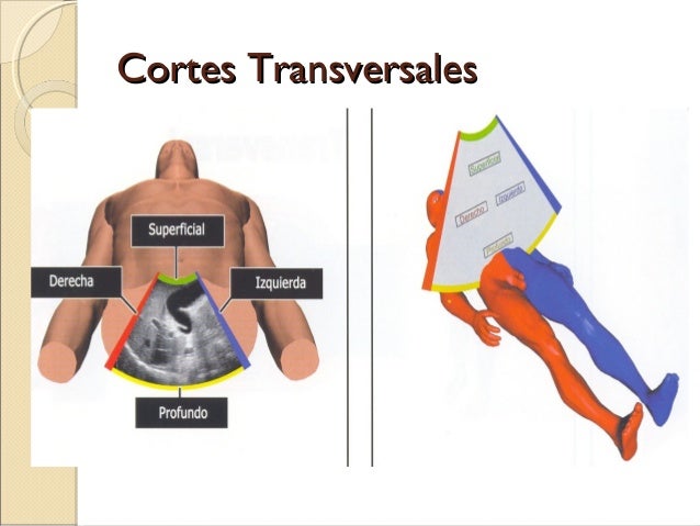 Ecografía cortes anatómicos