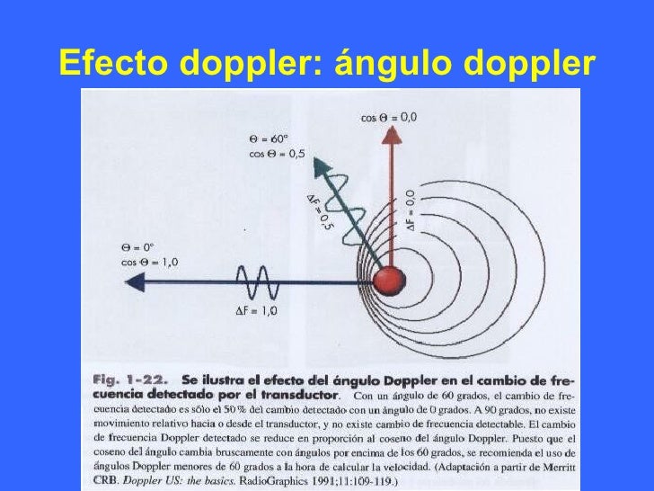Ecografía y ecodoppler