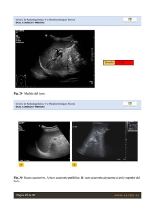 Ecografía de abdomen para principiantes.pdf