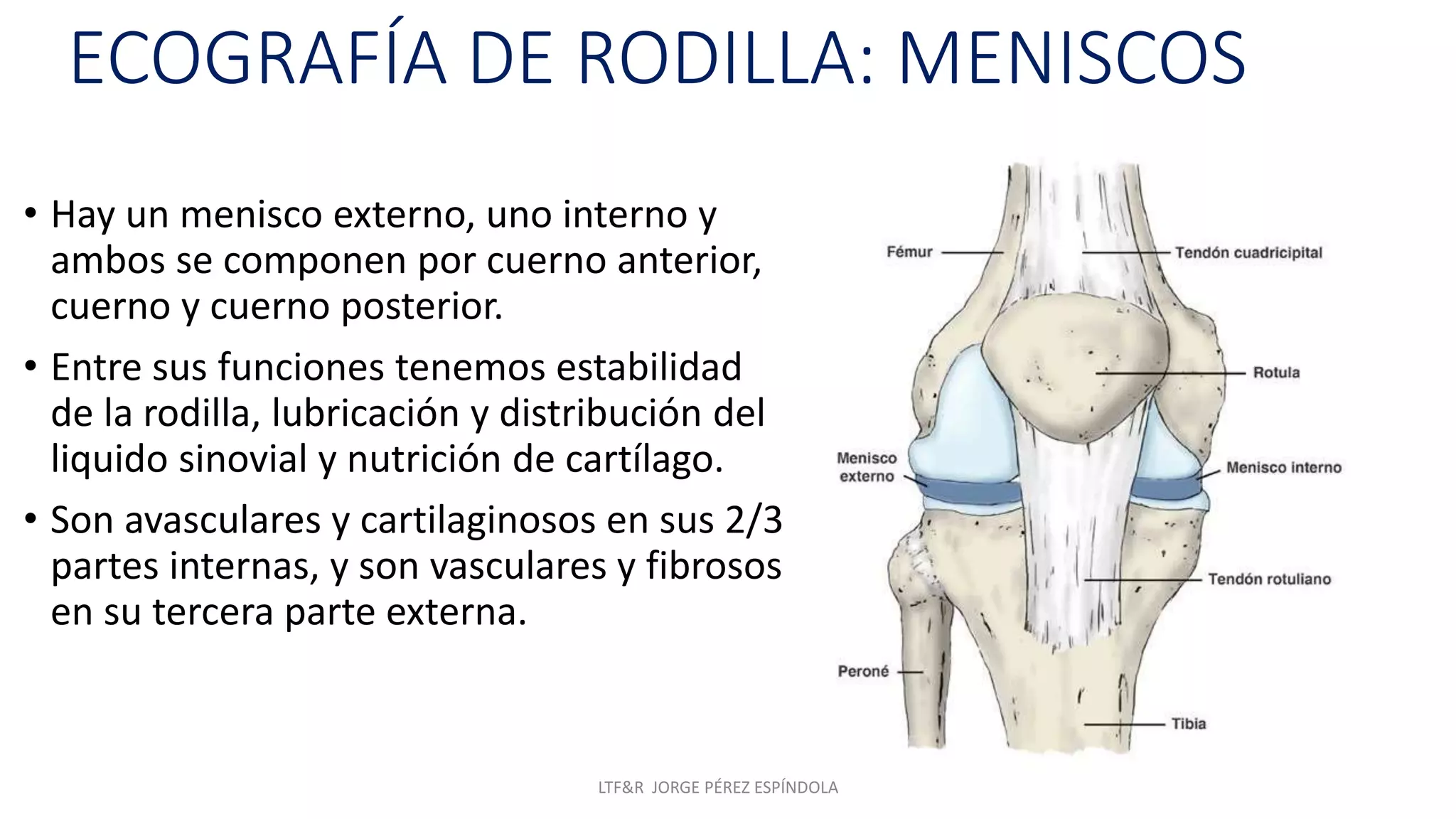 ECOGRAFÍA DE MENISCOS DE RODILLA.pptx
