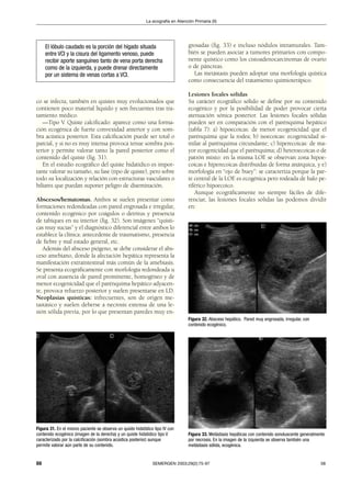 Ecografía Hepatica - bases e introduccion fundamentos basicos | PDF