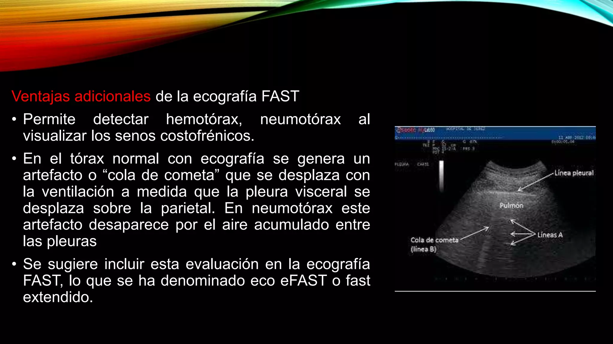 Ecografía FAST (Focused Abdominal Sonography for.pptx