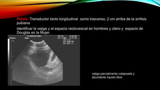Ecografía FAST (Focused Abdominal Sonography for.pptx