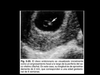Ecografía obstétrica normal xav | PPTX