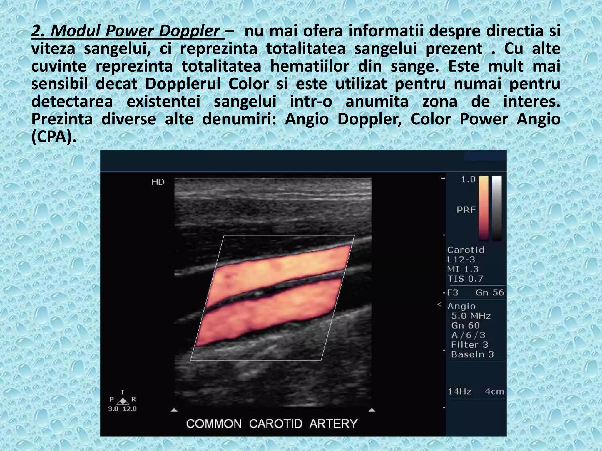 Ecografe si ultrasunete.pptx