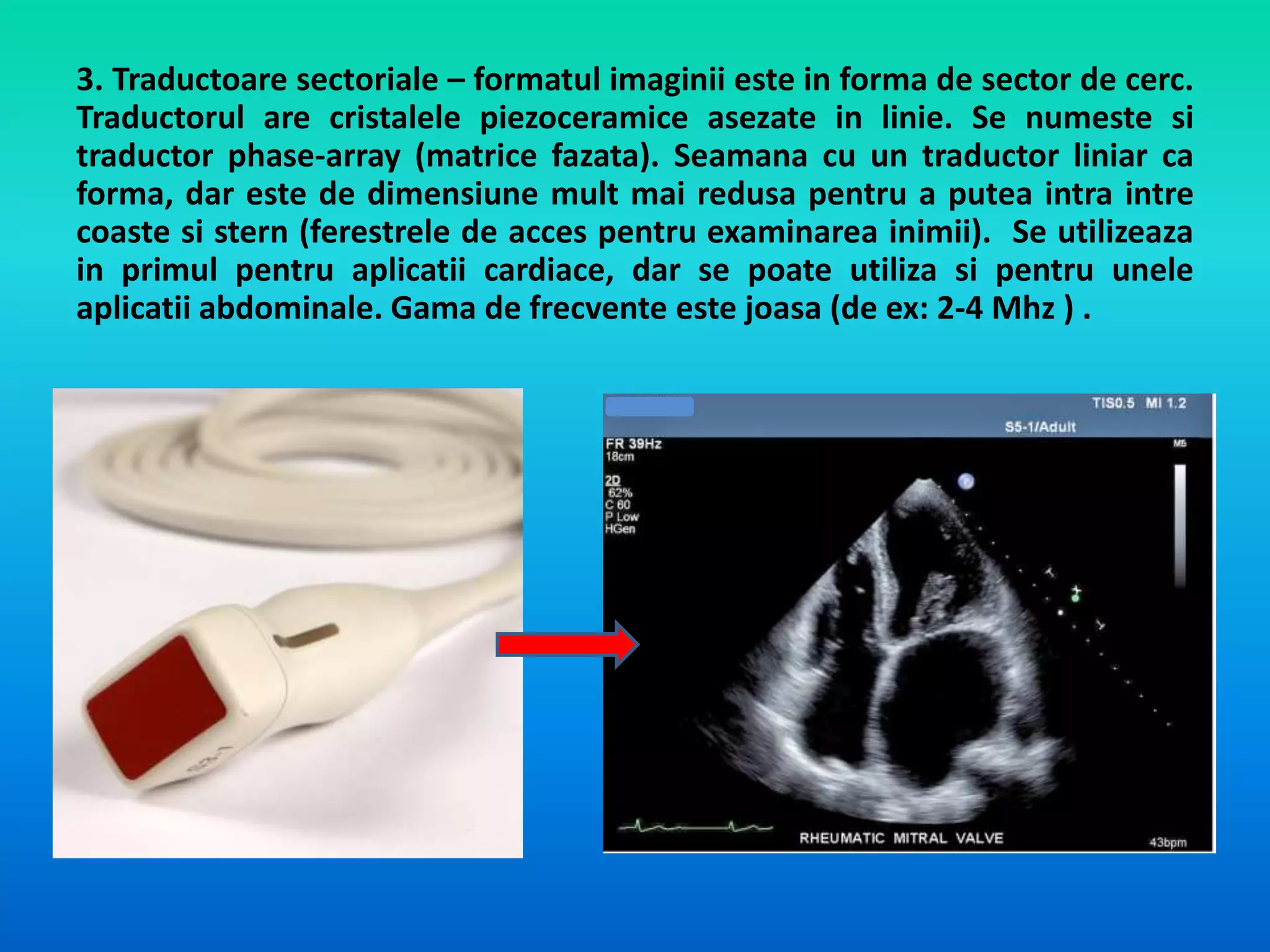 Ecografe si ultrasunete.pptx