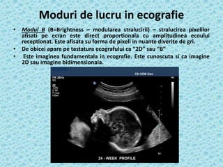 Ecografe si ultrasunete.pptx
