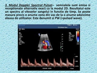 Ecografe si ultrasunete.pptx
