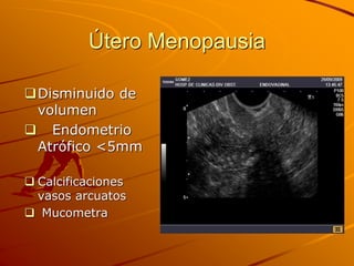 Ecografia citep | PPTX