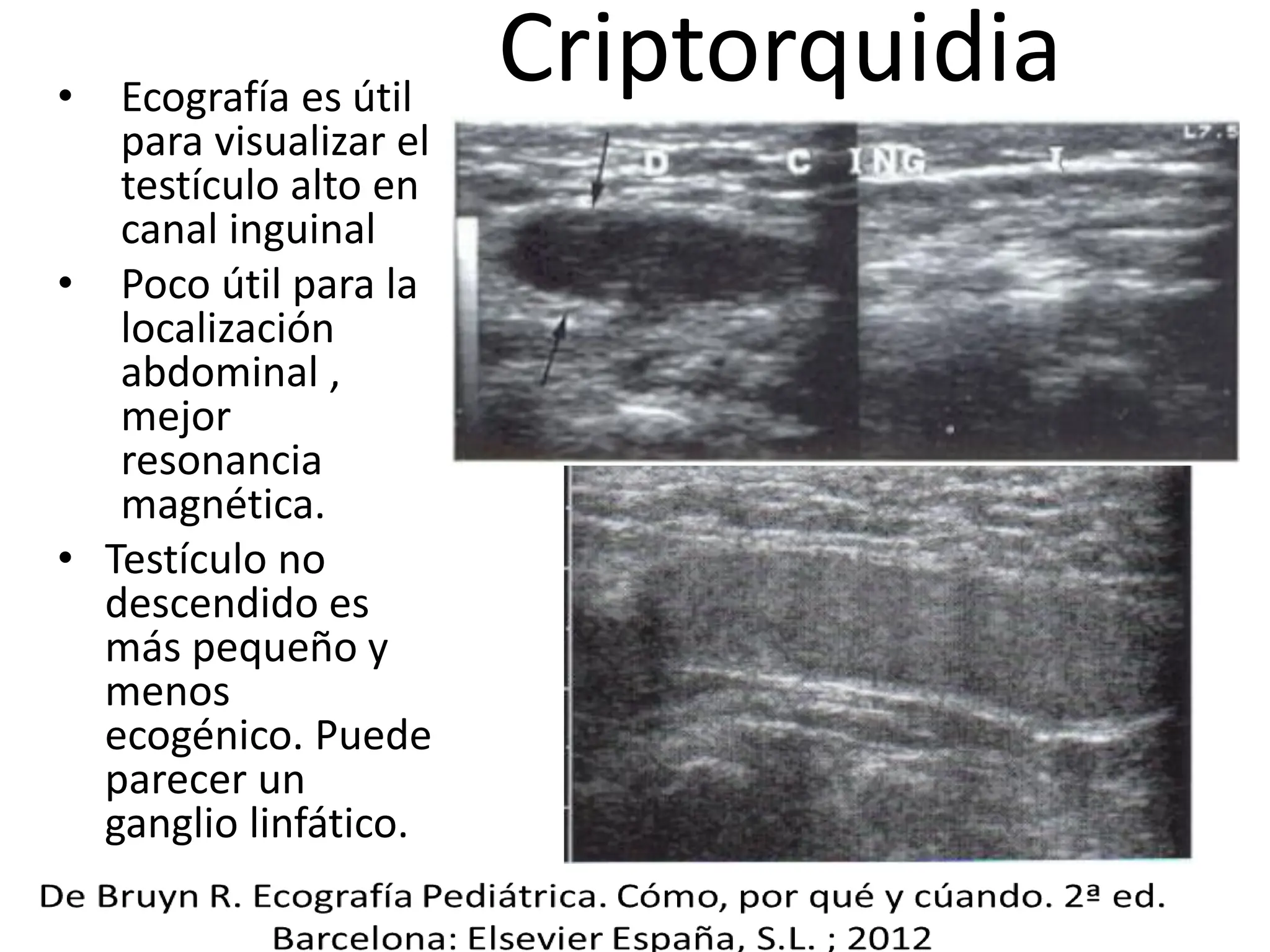 ecografia_clinica_en_patologia_escrotal_y_testicular_en_ninos_y ...