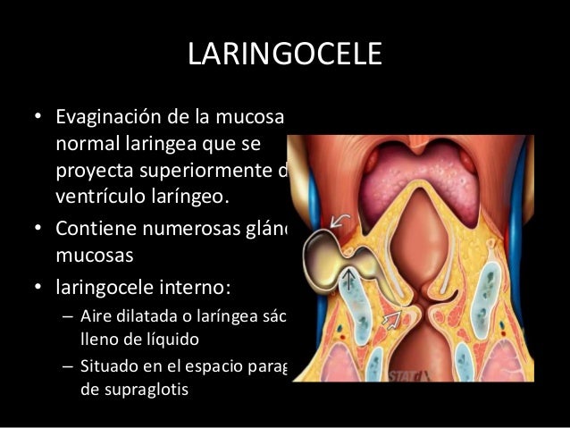 Ecografia de cuello en ecografia.