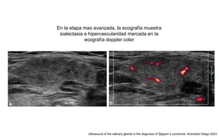 ECOGRAFIA DE LAS GLANDULAS SALIVALES.pptx