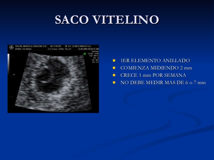 Ultrassom Do Saco Vitelino Humano